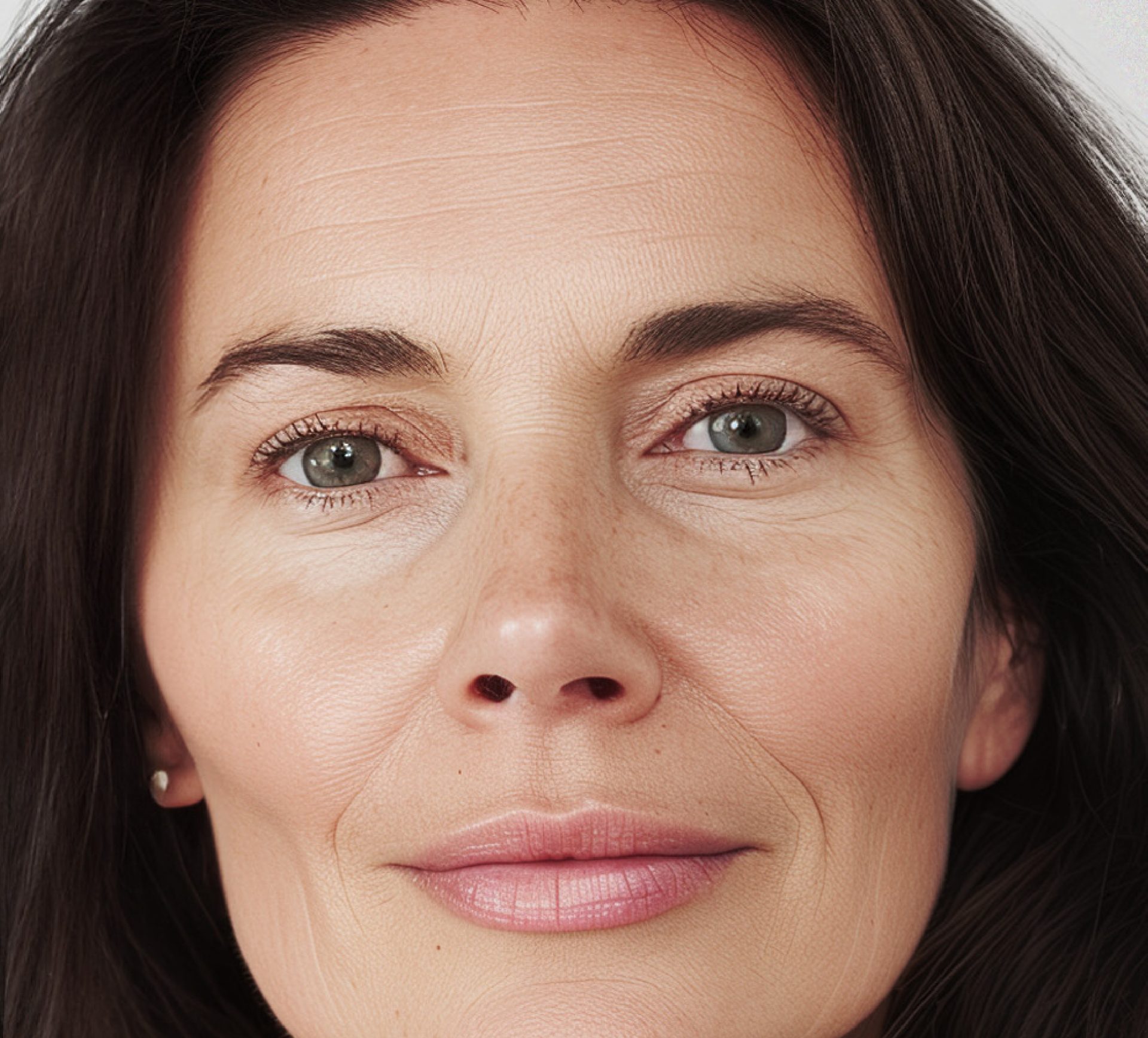 Gliding brow lift - V CLINIC Brno